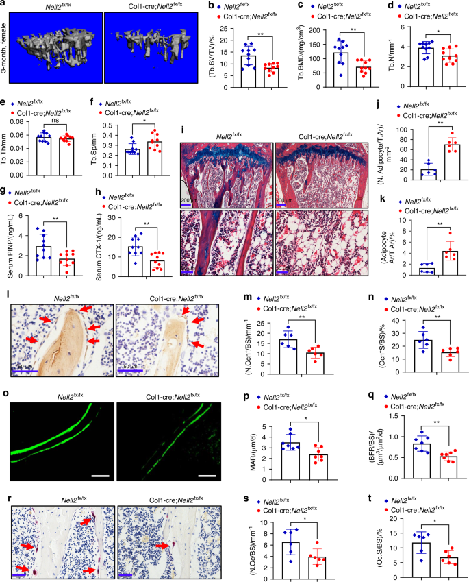 NELL2, a novel osteoinductive factor, regulates osteoblast ...
