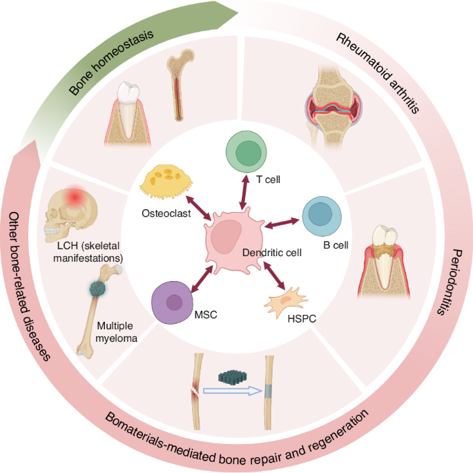 Unraveling the mechanisms of bone diseases: targeting dendritic cells in osteoimmunology for ...