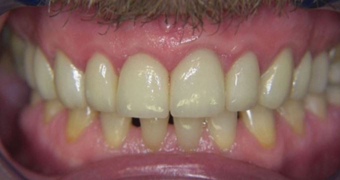 Valid consent? | British Dental Journal