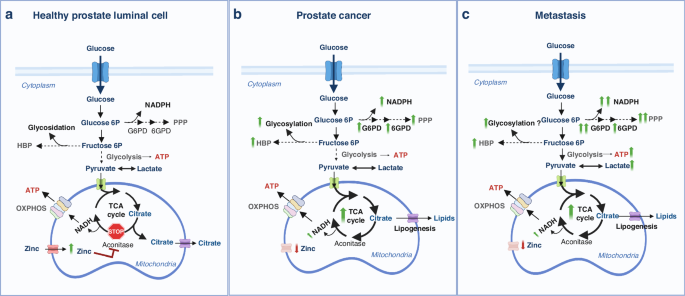 Metabolic adaptations in prostate cancer | British Journal of Cancer