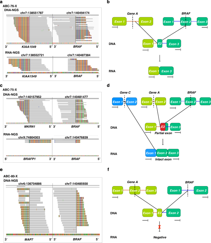 Unveiling the BRAF fusion structure variations through DNA and RNA ...