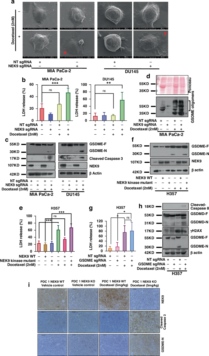 NEK9-mediated Wnt signalling repressor TLE3 rewires Docetaxel resistance in cancer cells by ...