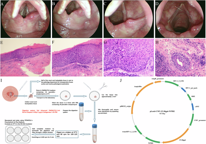 Establishment and characterization of the first immortalized vocal cord ...