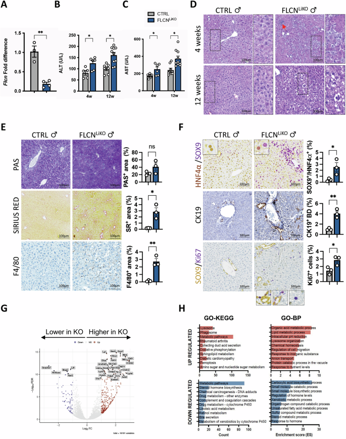 Folliculin depletion results in liver cell damage and ...