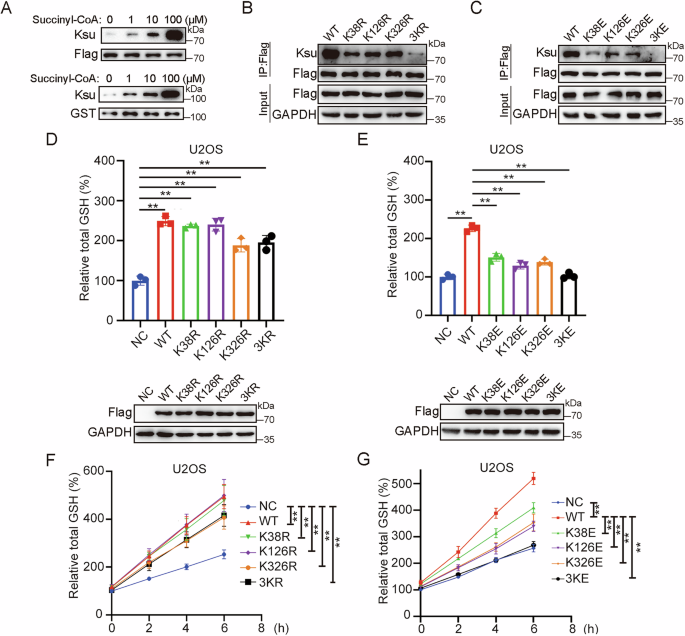 GCLC desuccinylation regulated by oxidative stress protects human ...