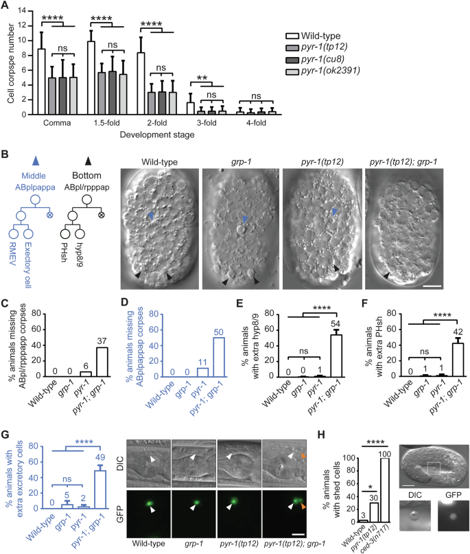Uridine 5’-monophosphate (UMP) synthesis connects nucleotide metabolism ...