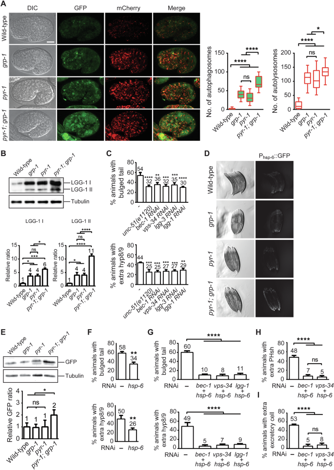 Uridine 5’-monophosphate (UMP) synthesis connects nucleotide metabolism ...