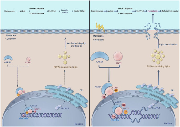 AARS1-mediated lactylation of H3K18 and STAT1 promotes ferroptosis in ...
