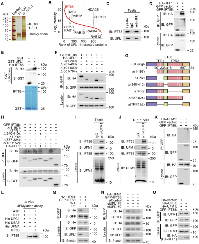 UFL1-mediated UFMylation antagonizes IFT88 ubiquitination and ...