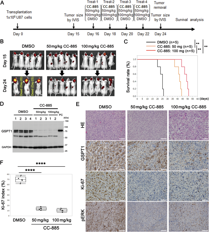 Potential of GSPT1 as a novel target for glioblastoma therapy | Cell ...