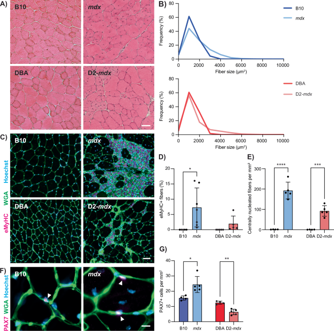 Muscle stem cells in Duchenne muscular dystrophy exhibit molecular ...