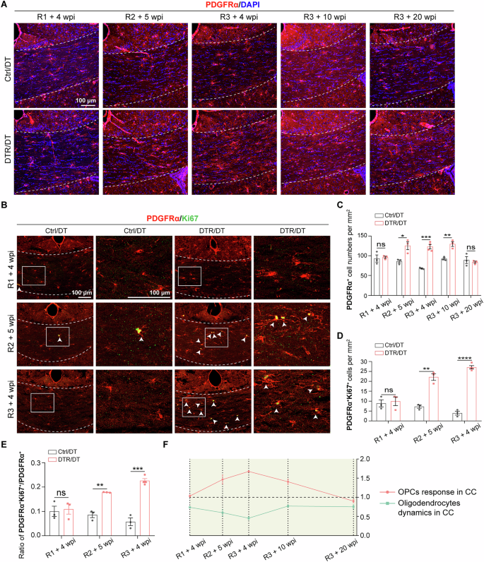 Repeated ablations of mature Tmem10+ oligodendrocytes recapitulates key ...