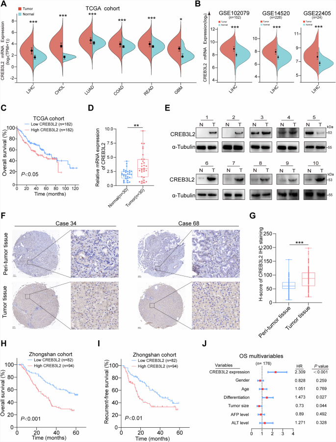 Targeting CREB3L2-mediated lipid metabolism overcomes lenvatinib ...
