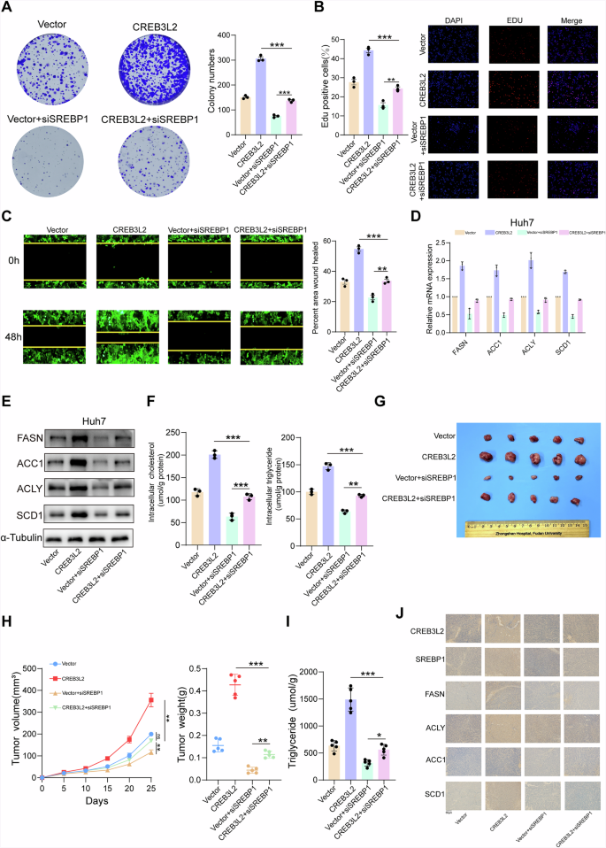 Targeting CREB3L2-mediated lipid metabolism overcomes lenvatinib ...