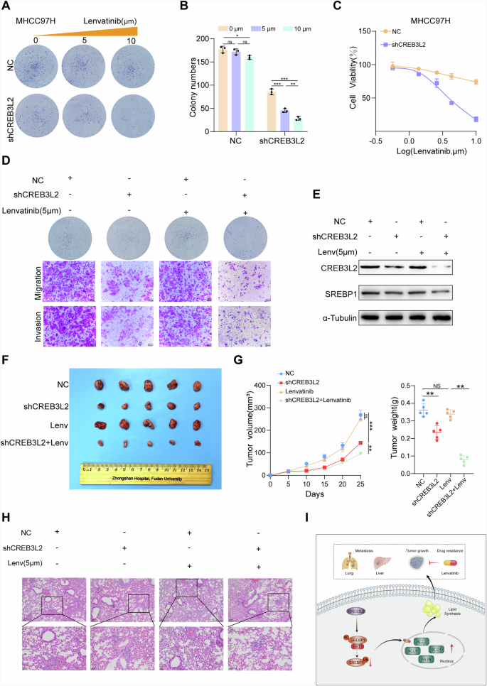 Targeting CREB3L2-mediated lipid metabolism overcomes lenvatinib ...