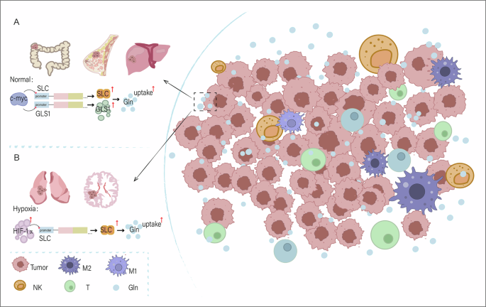 Glutamine: a new strategy for targeted metabolic therapy in the tumor ...