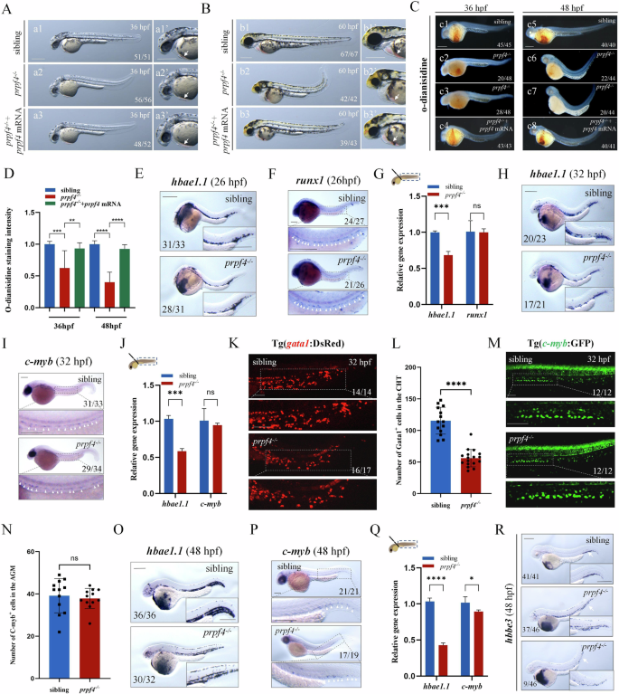 Prpf4 sequentially regulates the expansion and maturation of ...