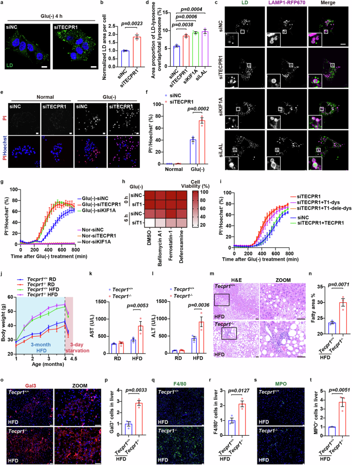 Repair of damaged lysosomes by TECPR1-mediated membrane tubulation ...