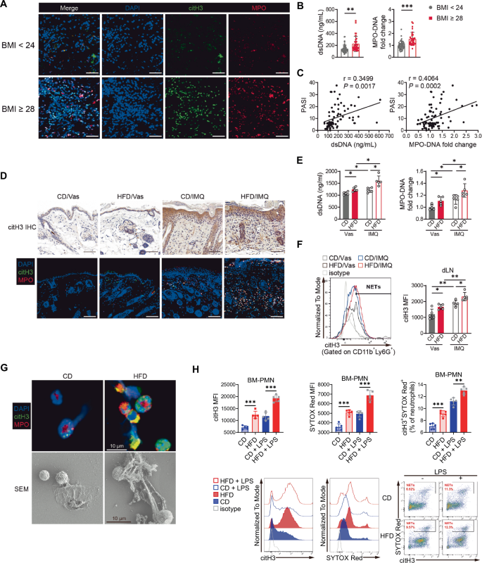 Saturated fatty acid-induced neutrophil extracellular traps contribute ...