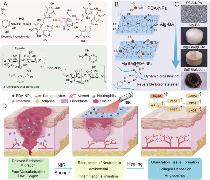 An in-situ self-gelation photothermal alginate-based sponge dressing ...