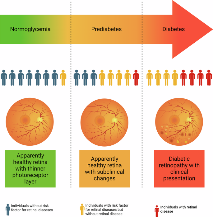 A new population for primary prevention of retinal diseases; a step ...