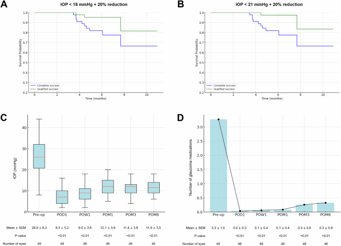 Short-term efficacy and safety of A-stream glaucoma shunt: a 6-month ...