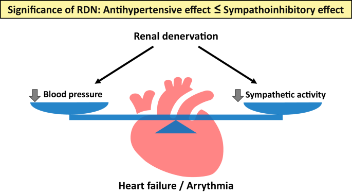 Renal denervation: a key approach to hypertension and cardiovascular ...