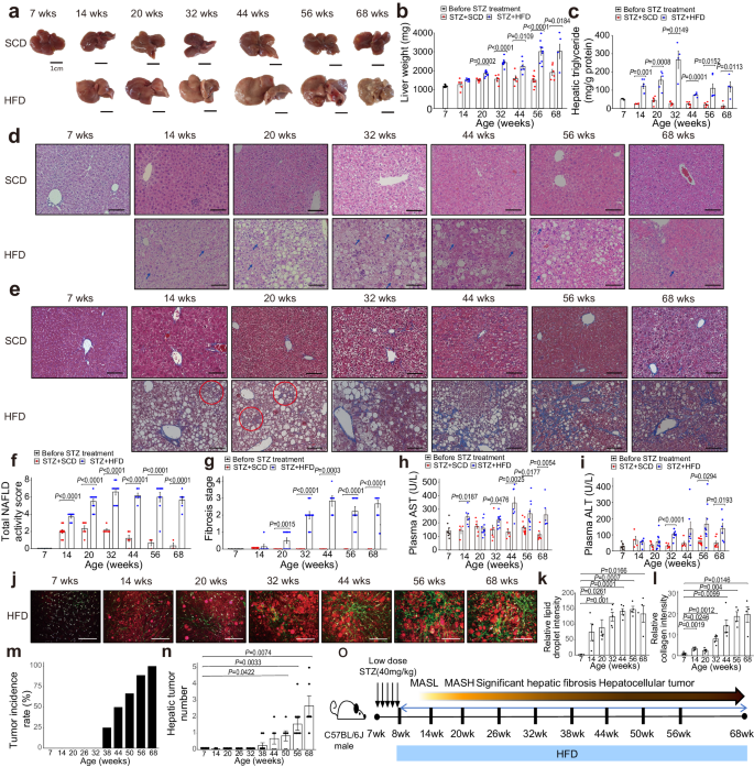 A male mouse model for metabolic dysfunction-associated steatotic liver ...