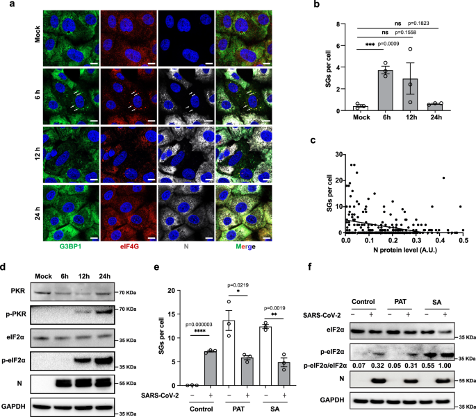 SARS-CoV-2 N protein recruits G3BP to double membrane vesicles to ...