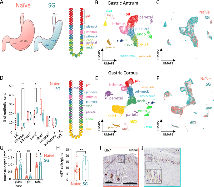 Sleeve gastrectomy reveals the plasticity of the human gastric ...