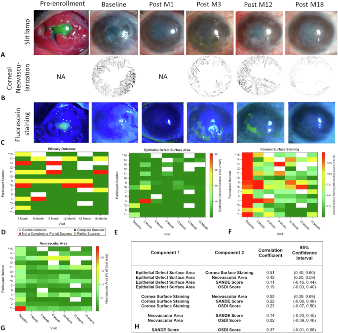 Cultivated autologous limbal epithelial cell (CALEC) transplantation ...