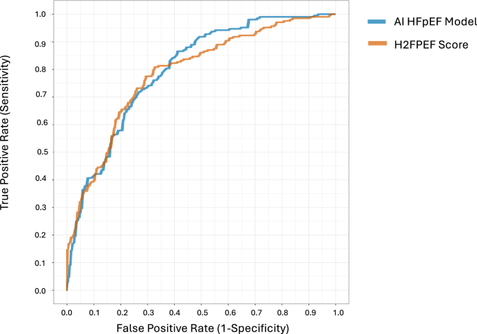 External validation of artificial intelligence for detection of heart ...