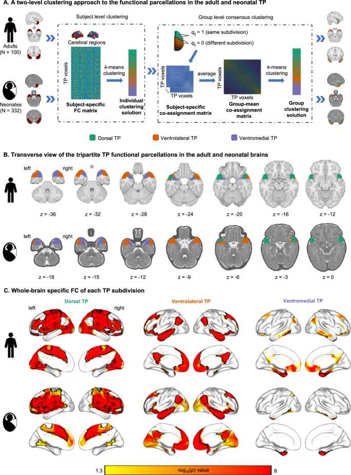 Innate network mechanisms of temporal pole for semantic cognition in ...