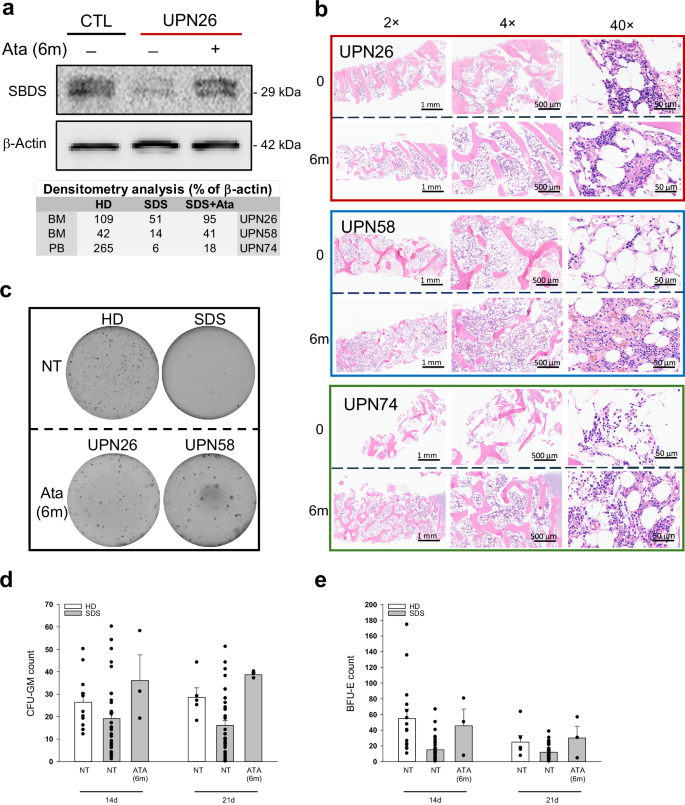 Ataluren improves hematopoietic and pancreatic disorders in Shwachman ...