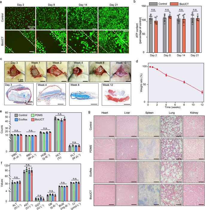 Biodegradable ultrasound contrast tape for tracing intestinal motility ...