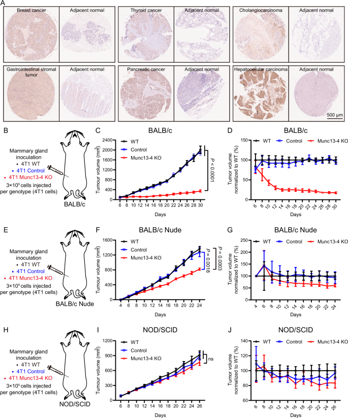 Munc13-4 mediates tumor immune evasion by regulating the sorting and ...