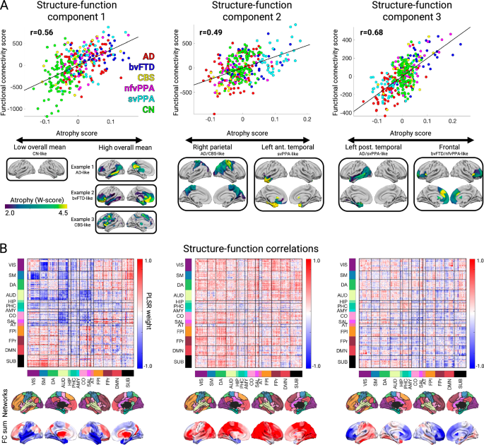 Functional network collapse in neurodegenerative disease | Nature ...