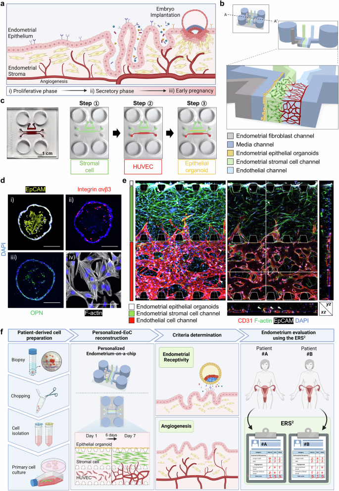 Microengineered patient-derived endometrium-on-a-chip for the ...