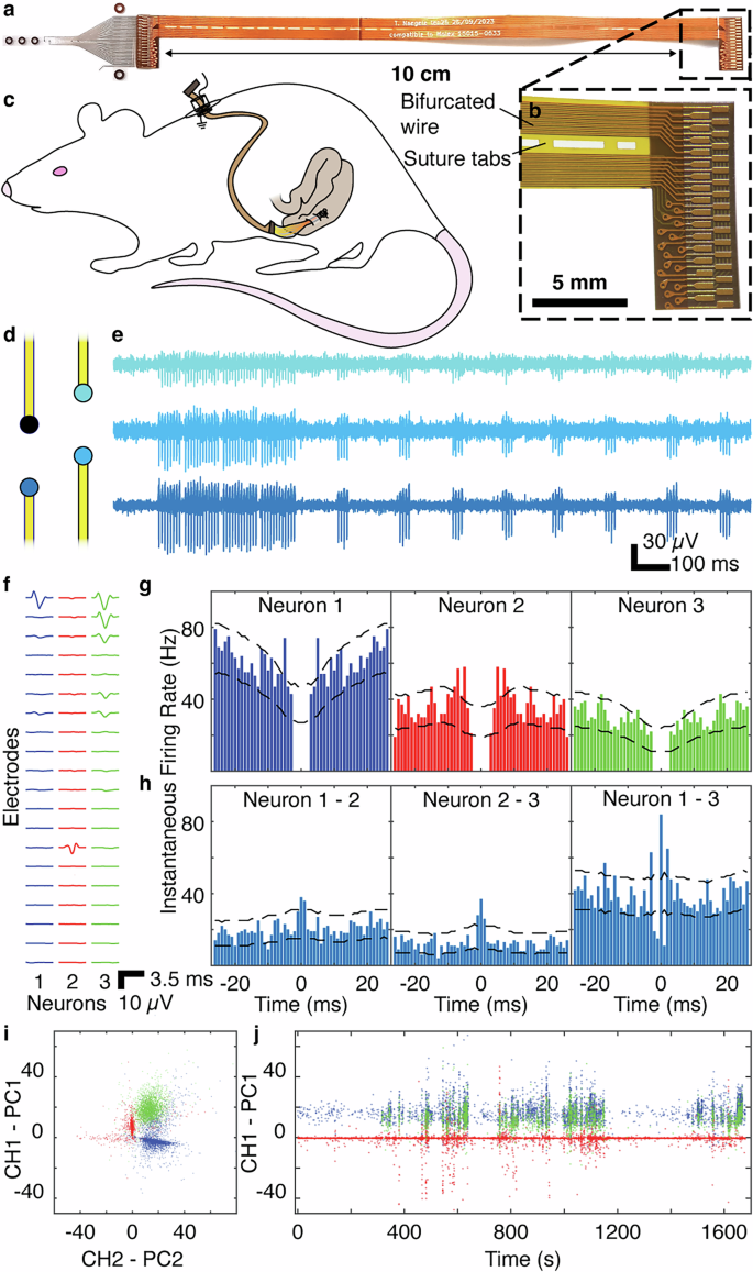 Implantable bioelectronics for gut electrophysiology | Nature ...