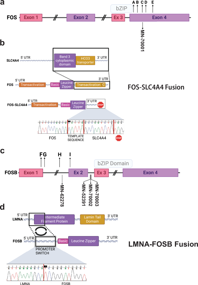 Subgroup of meningiomas involving FOS and FOSB gene fusions | Nature ...