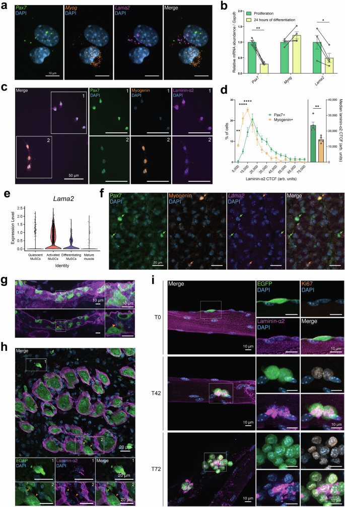 Loss of cell-autonomously secreted laminin-α2 drives muscle stem cell ...