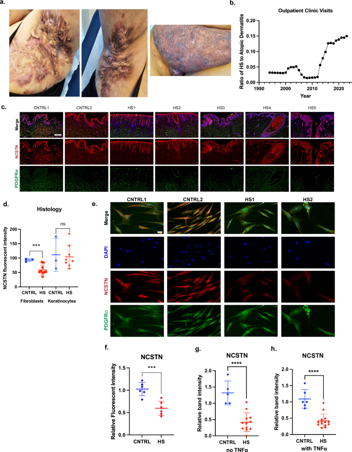 Plastic associated endocrine disruptors reduce Nicastrin protein and ...
