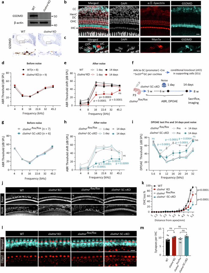 Supporting cells orchestrate noise-induced hearing loss via a Gasdermin ...