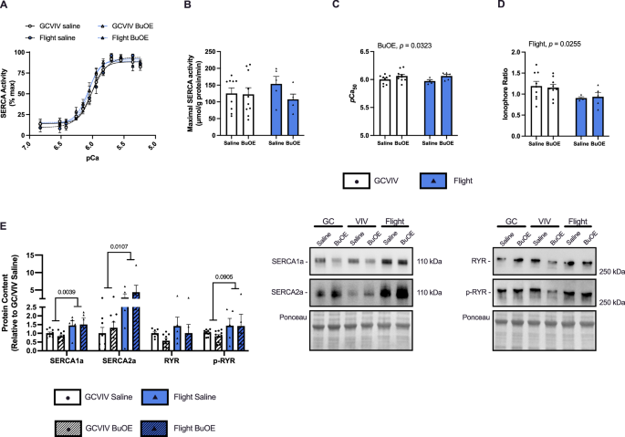 Spaceflight increases sarcoplasmic reticulum Ca2+ leak and this cannot ...