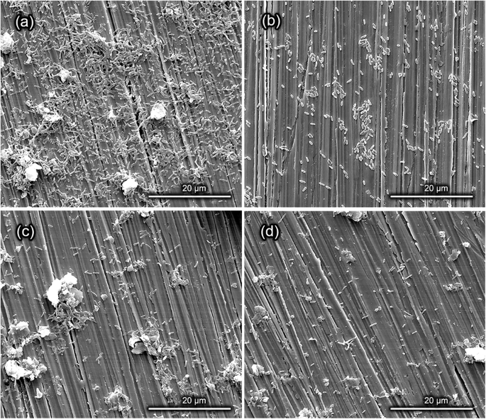 Influence of multilayer sea sand and Shewanella algae on the corrosion ...