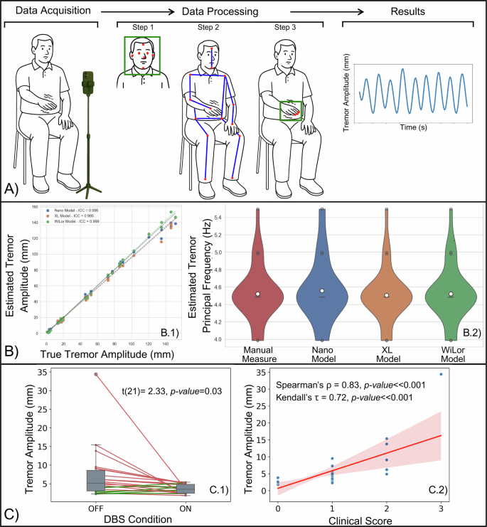 Video-based quantification of hand postural tremor without external ...