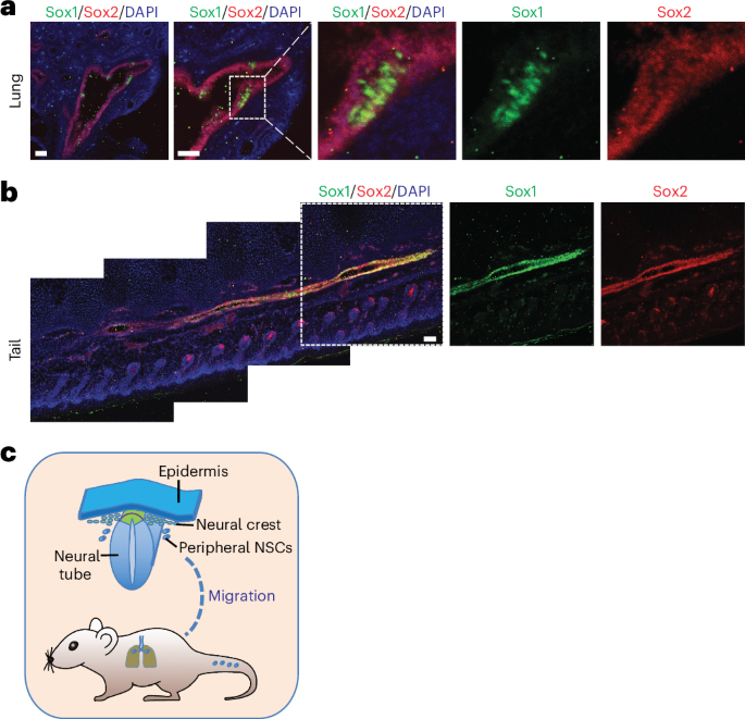 Peripheral neural stem cells from the neural tube contribute to multi ...