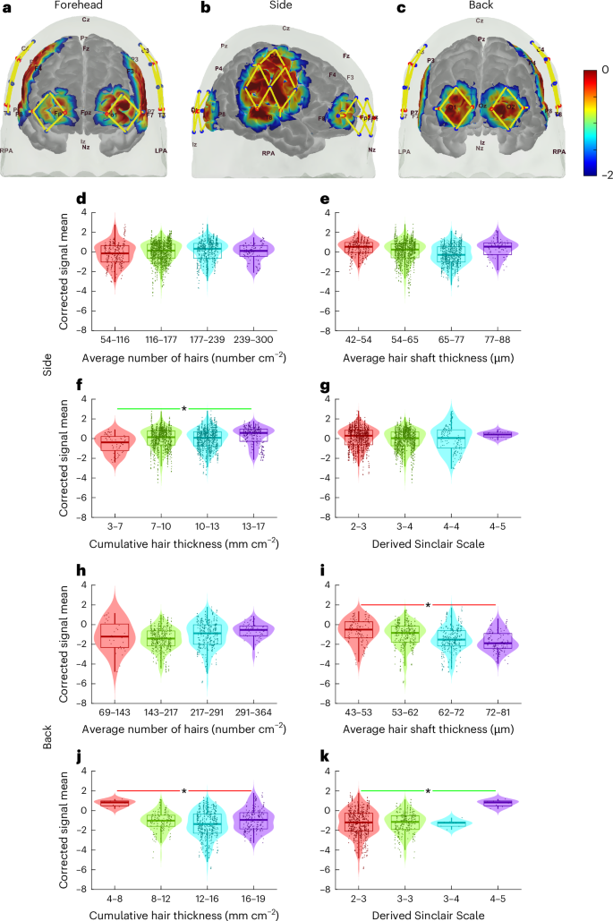 Quantifying the impact of hair and skin characteristics on fNIRS signal ...