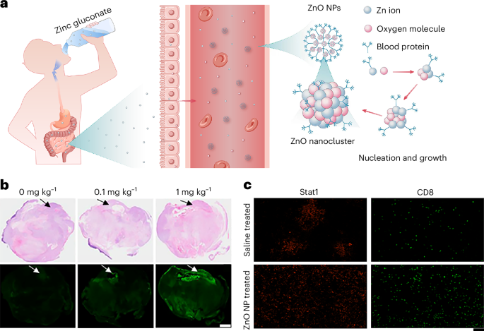 Zinc nanoparticles produced by the human body have potential antitumour ...
