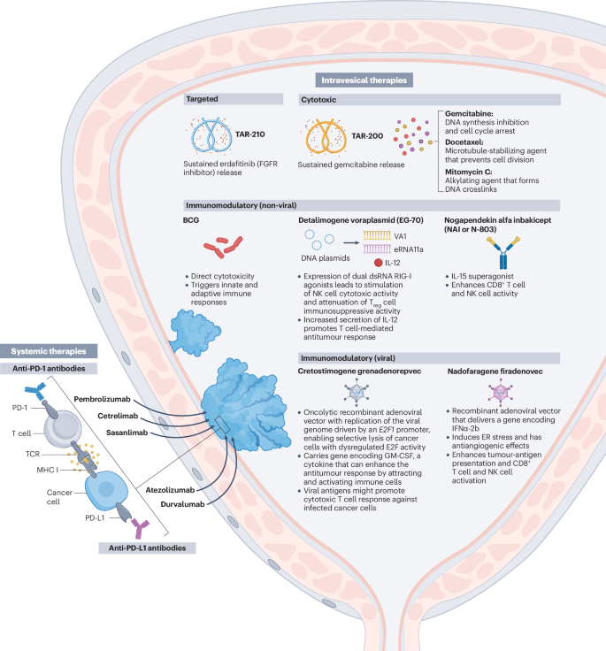 Advances in the management of localized bladder cancers | Nature ...
